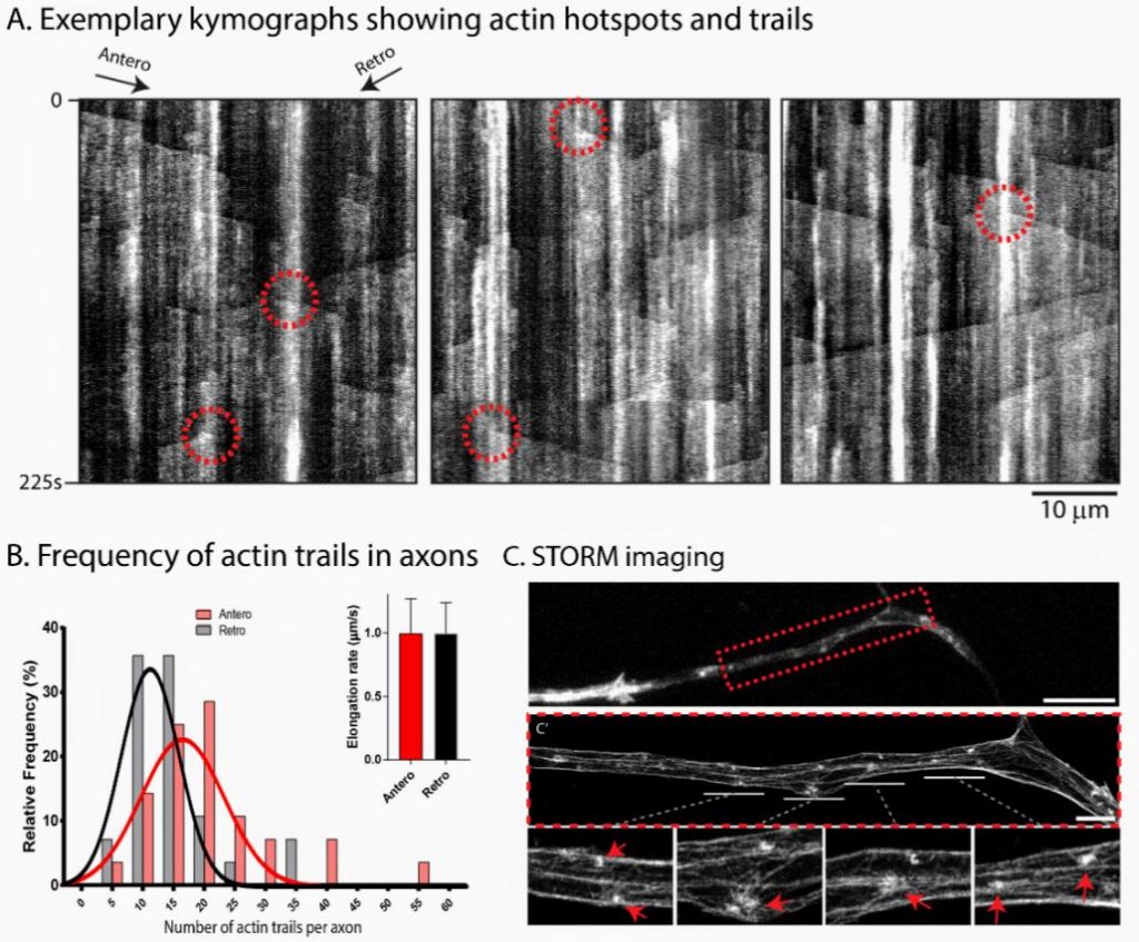 New preprint: a mechanism for the slow axonal transport of actin ...