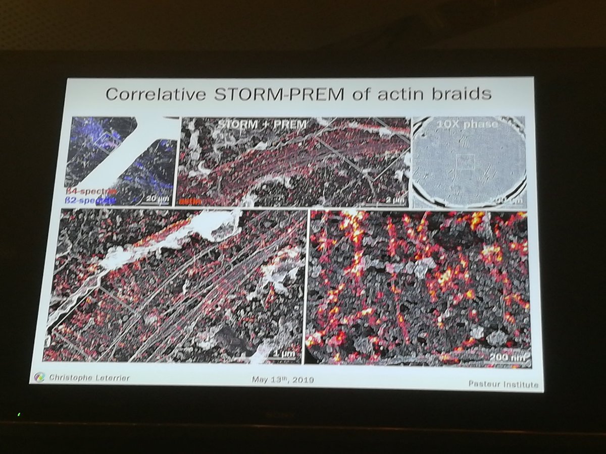 Fluorescence Microscopy Workshop at Institut Pasteur – NeuroCyto Lab