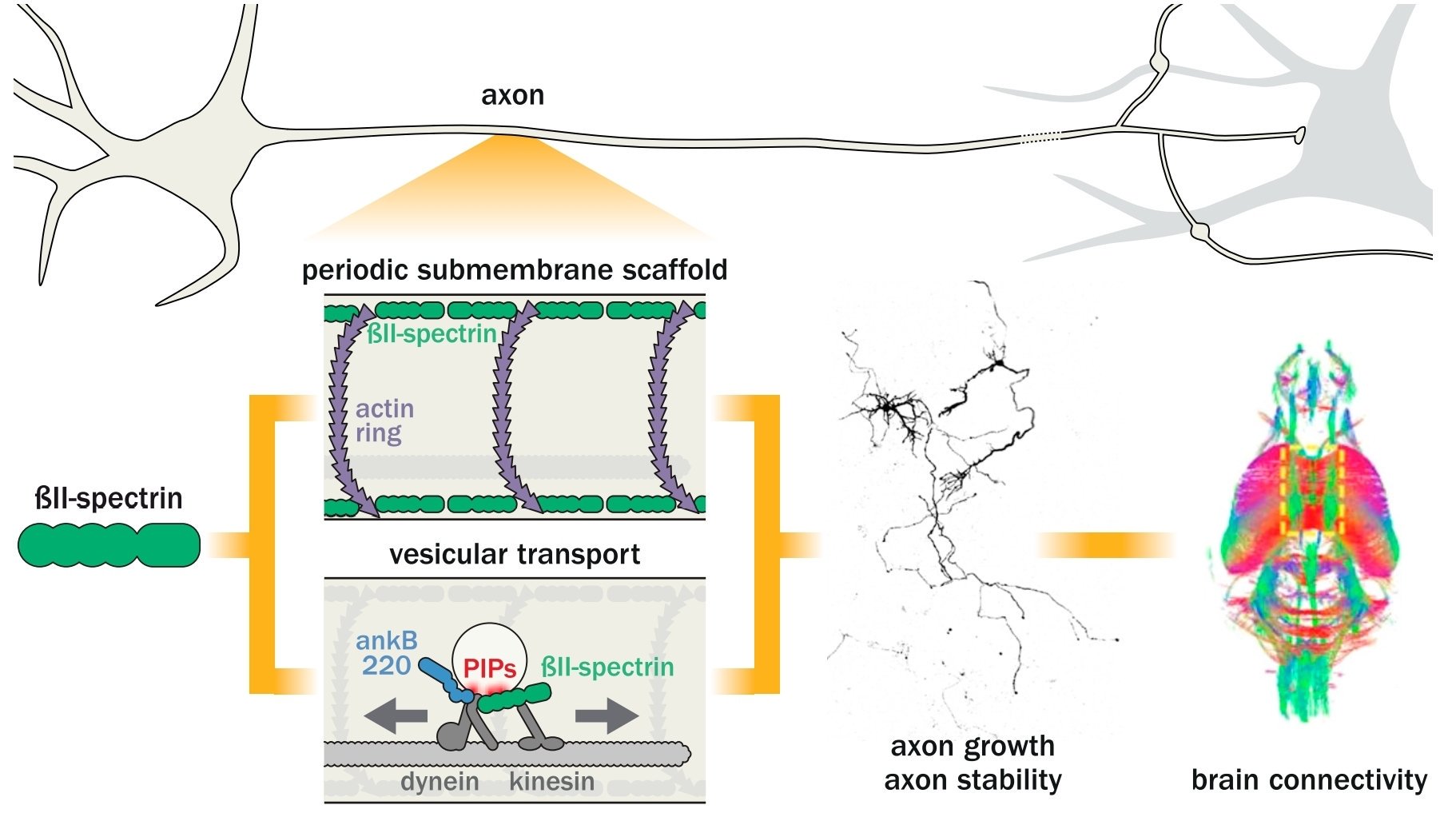 Just out: commentary on how ß2-spectrin drives axonal transport ...